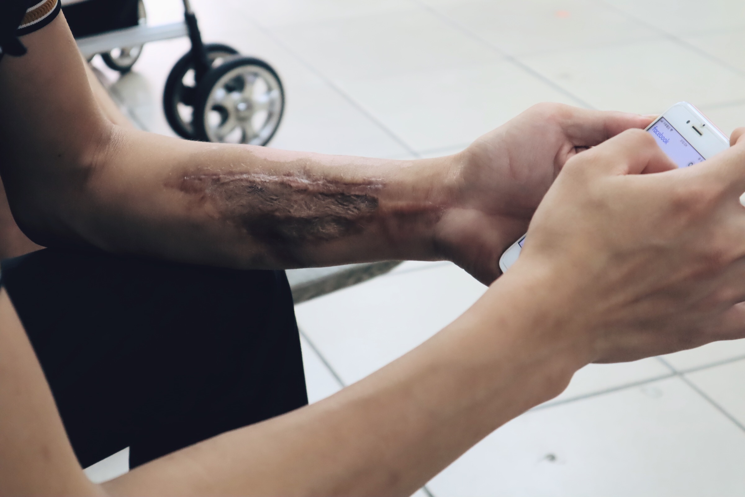 I lost a hand in Taiwan when I only came here to work | 桃園市群眾服務協會